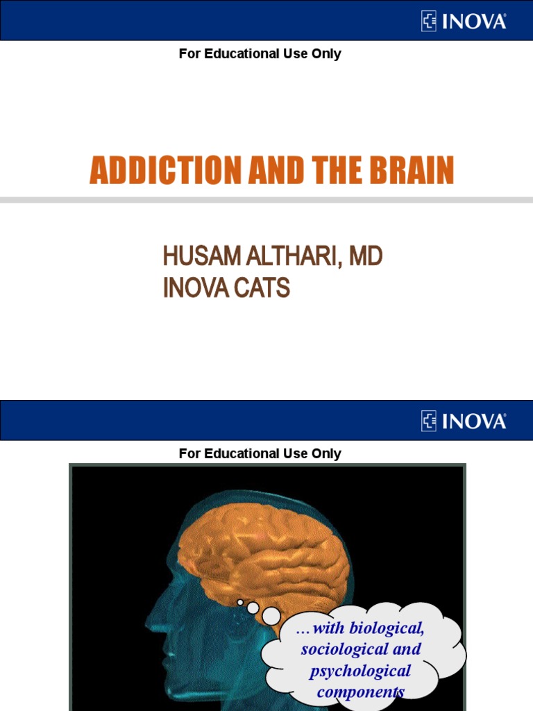 Addiction and The Brain Inova Template 002 | PDF | Substance Abuse ...