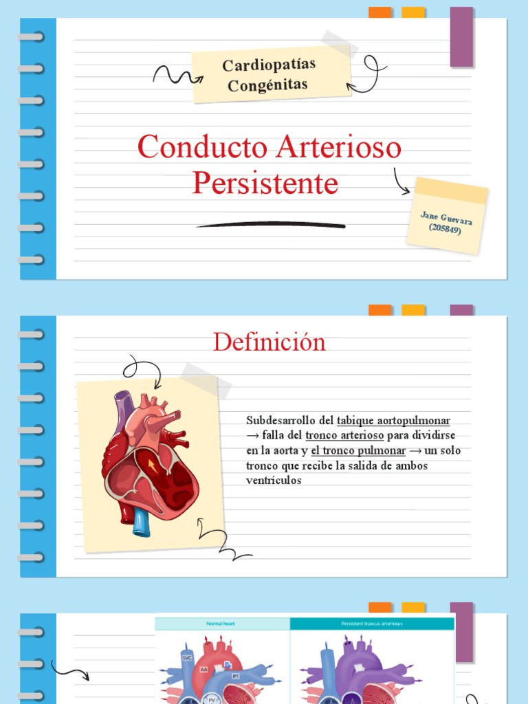 Conducto Arterioso Persistente | PDF | Aorta | Defecto cardiaco congenito