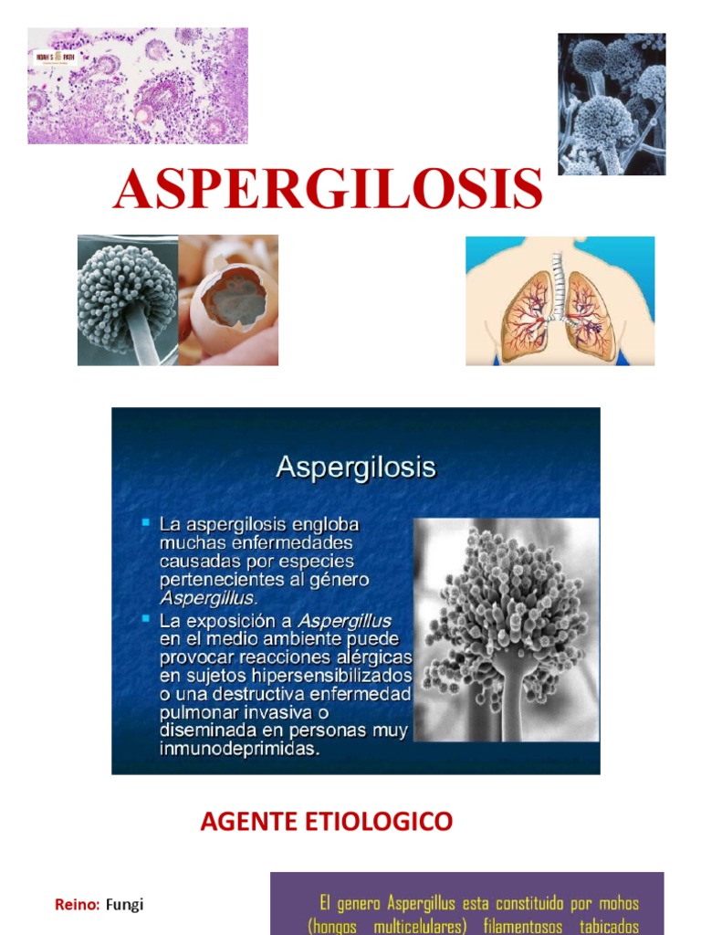 Aspergilosis: Diagnóstico y Epidemiología | PDF | Alergia | Enfermedades animales