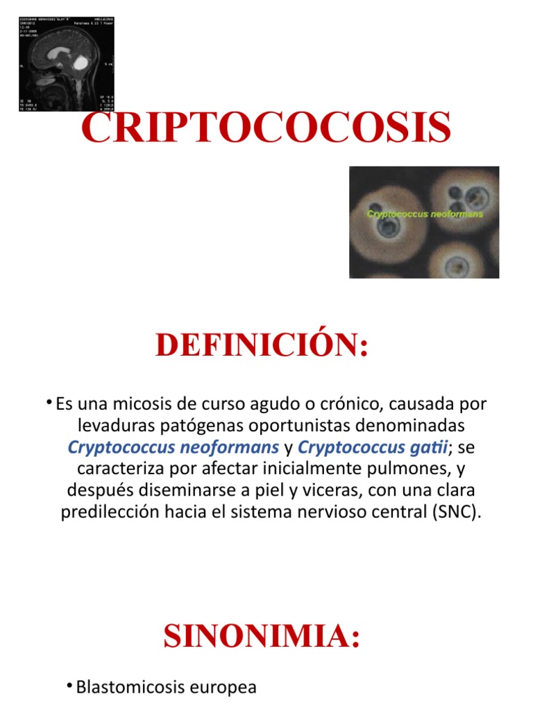 CRIPTOCOCOSIS | PDF | Especialidades Medicas | Medicina CLINICA