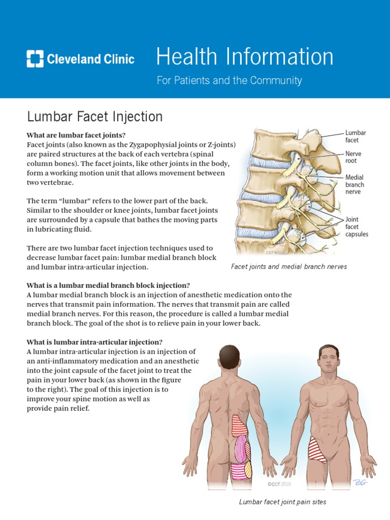 Lumbar-Facet-Injection Pic | PDF | Clinical Medicine | Medical Specialties