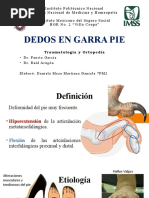 Onicectomía: Procedimiento y Cuidados | PDF | Clavo (anatomía) | Dedo ...