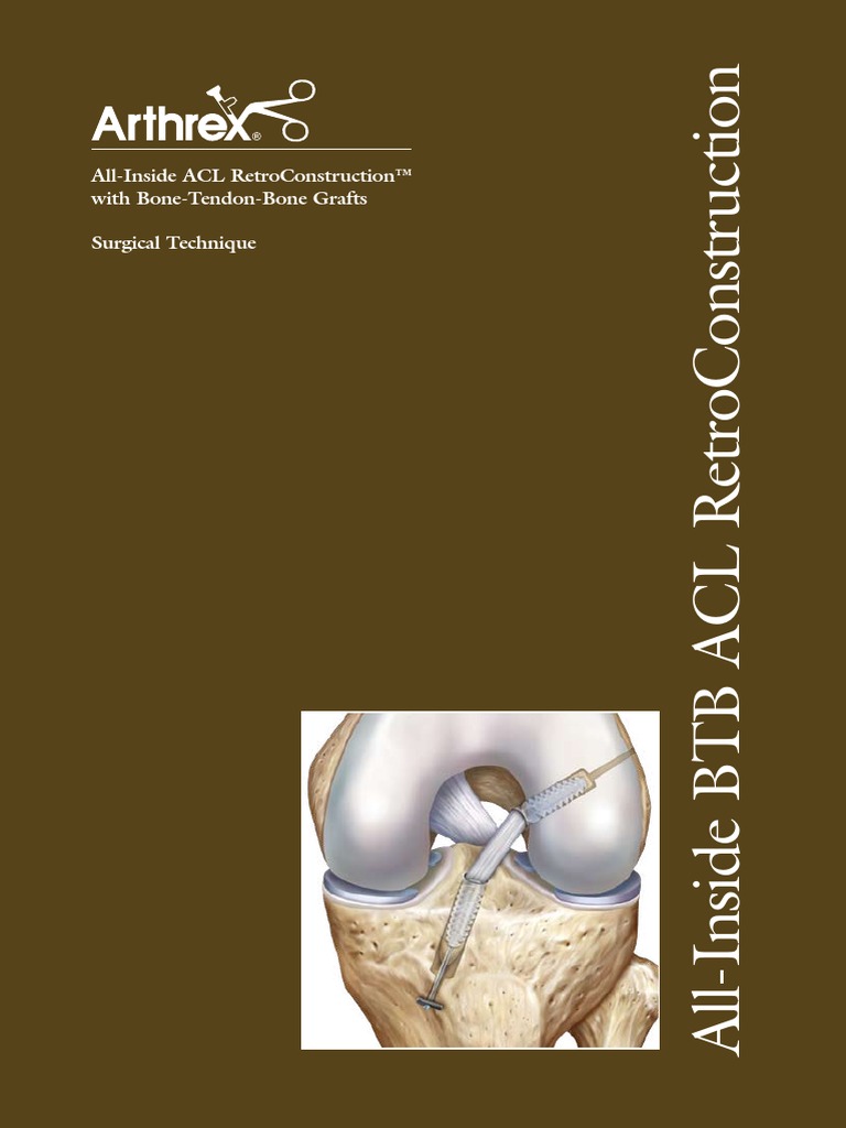 Arthrex All Inside ACL Repair BTB | PDF | Knee | Musculoskeletal System