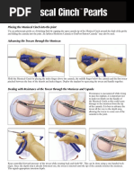 TKR Smith&nephew Technique Orthomatch GENESIS II Surgical Technique.10. ...