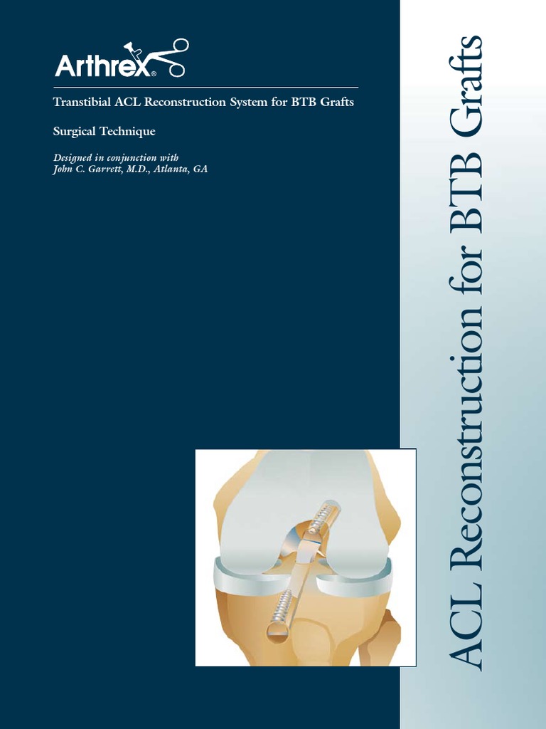 Arthrex Transtibial ACL Reconstruction System For BTB Grafts | PDF ...