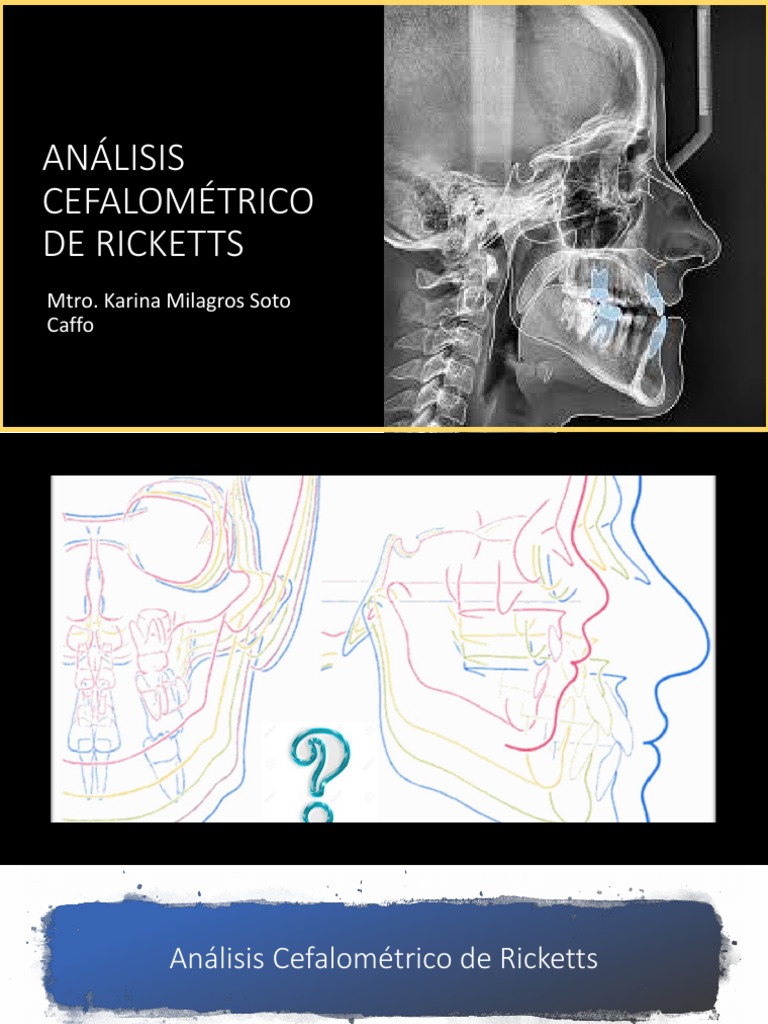 Análisis Cef de Ricketts | PDF | Anatomia dental | Ramas de Odontología
