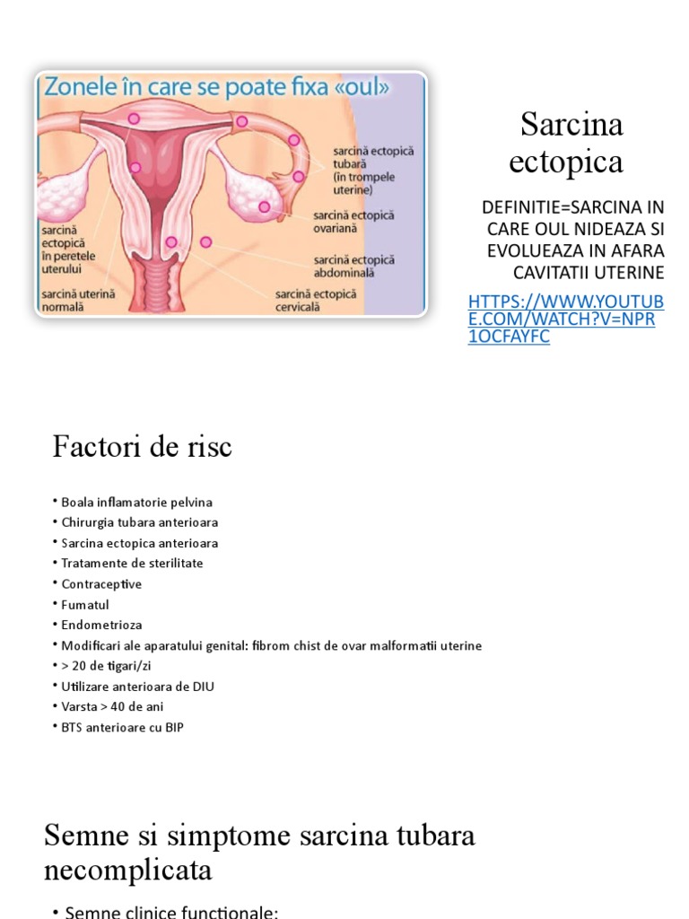 Sarcina Extrauterina | PDF