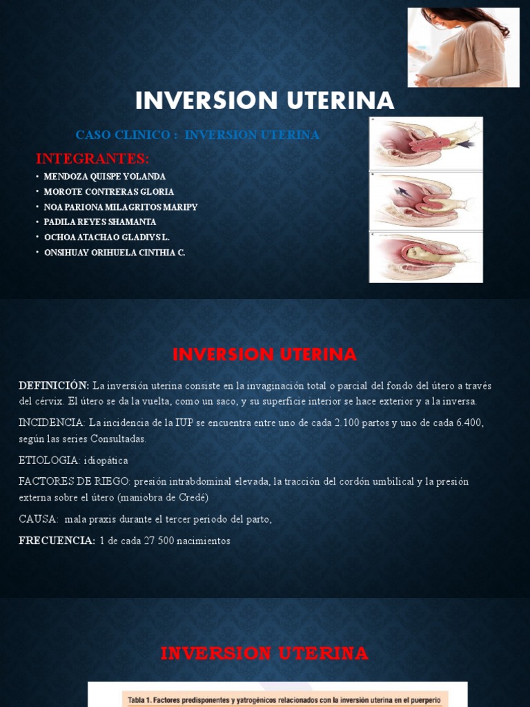 Inversion Uterina | PDF