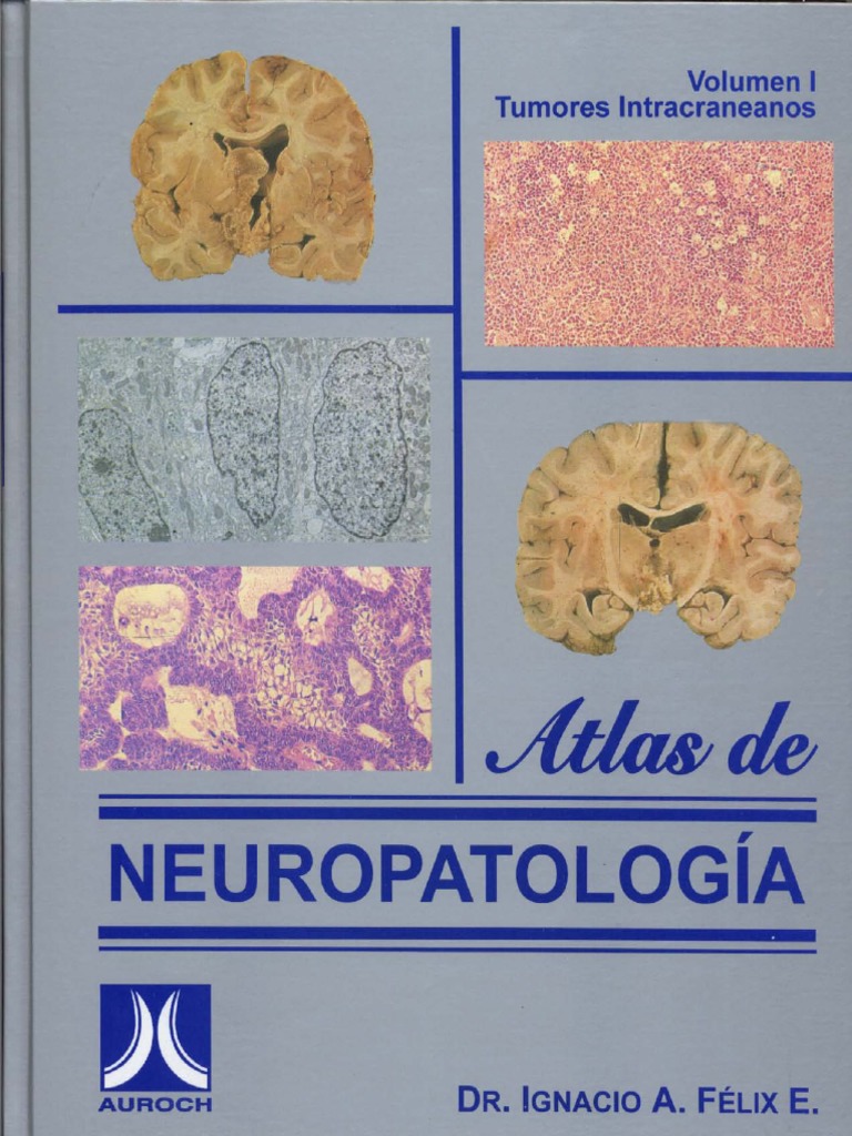 Atla de Neuropatologia Vol I - Felix | PDF