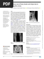 Dovate Ointment: Uses and Precautions | PDF | Dermatitis | Topical ...