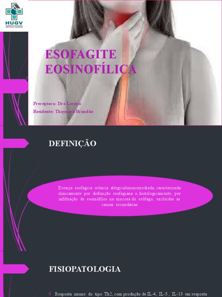 Esofagite Eosinofílica | PDF | Doença do refluxo gastroesofágico | Alergia