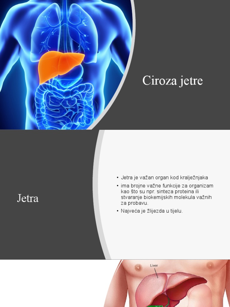 Ciroza Jetre | PDF