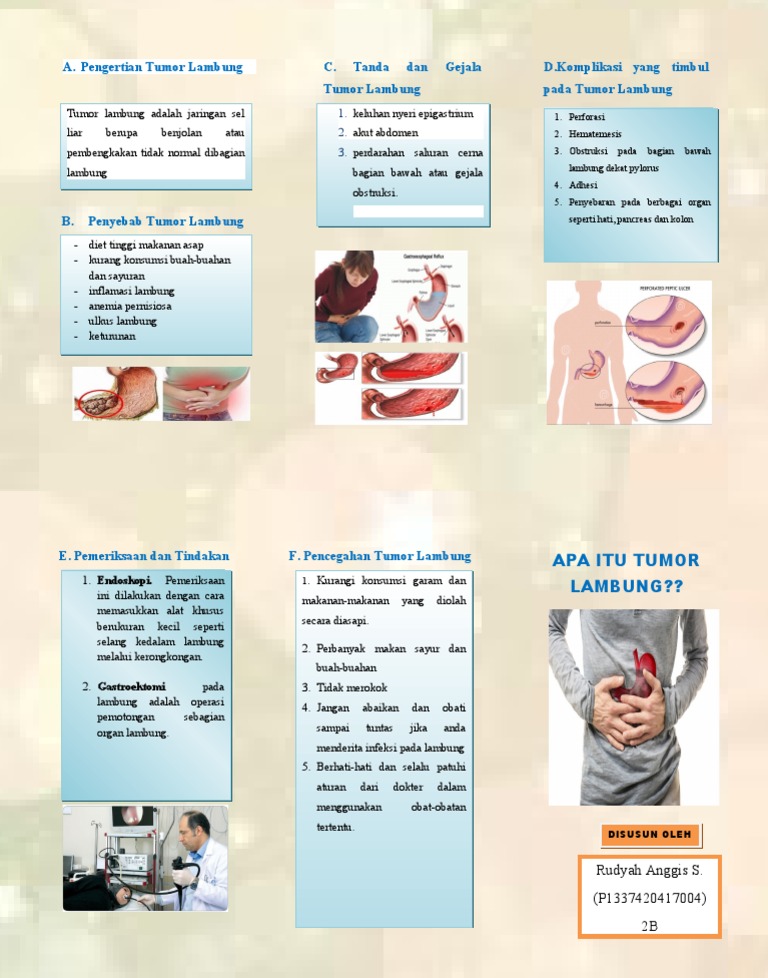 LEAFLET Kanker Lambung | PDF