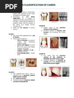 MBT Bracket Prescription | PDF | Orthodontics | Tooth