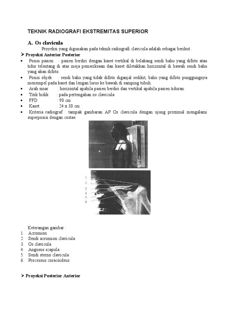 Teknik Radiografi Ekstremitas Superior | PDF