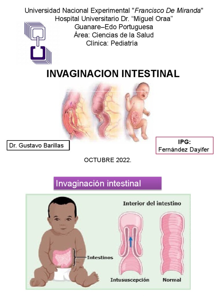 Invaginación Intestinal en Pediatría | PDF | Medicina CLINICA ...