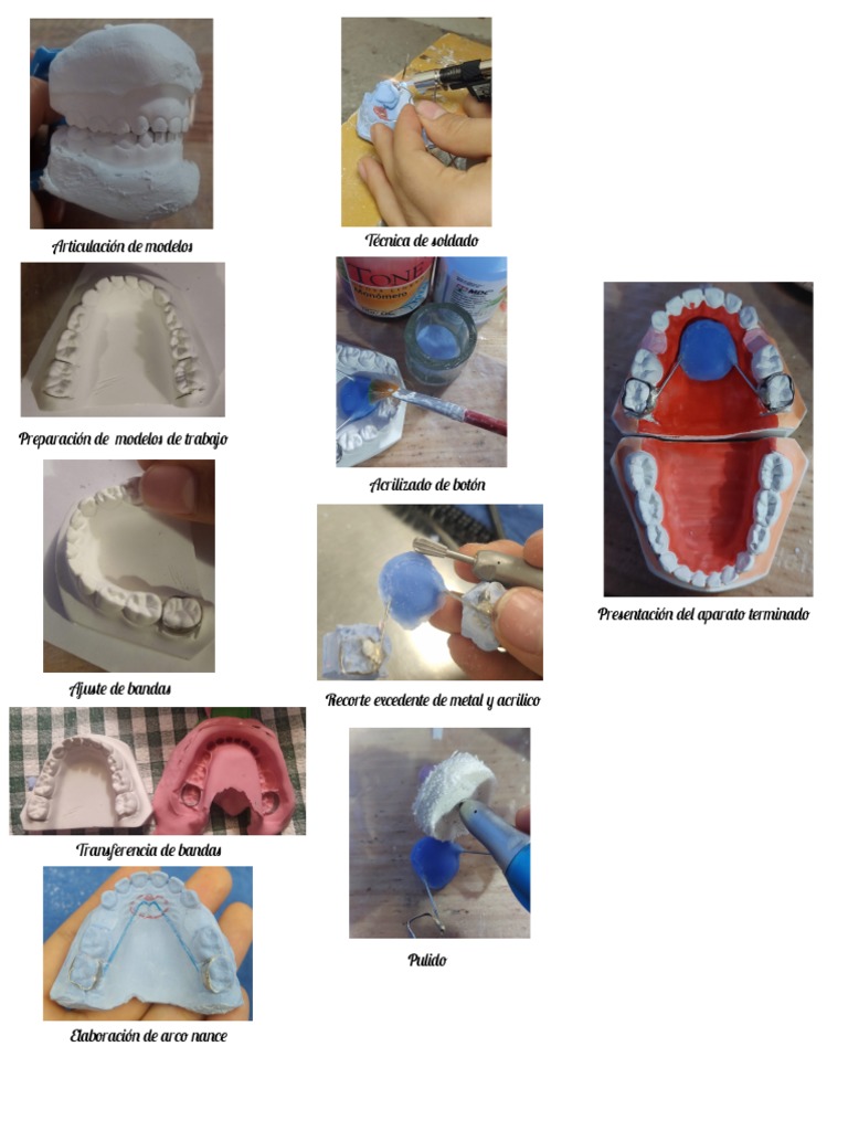 Botón de Nance | PDF