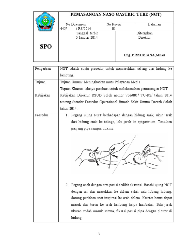 SPO Pemasangan Naso Gastric Tube (NGT) | PDF