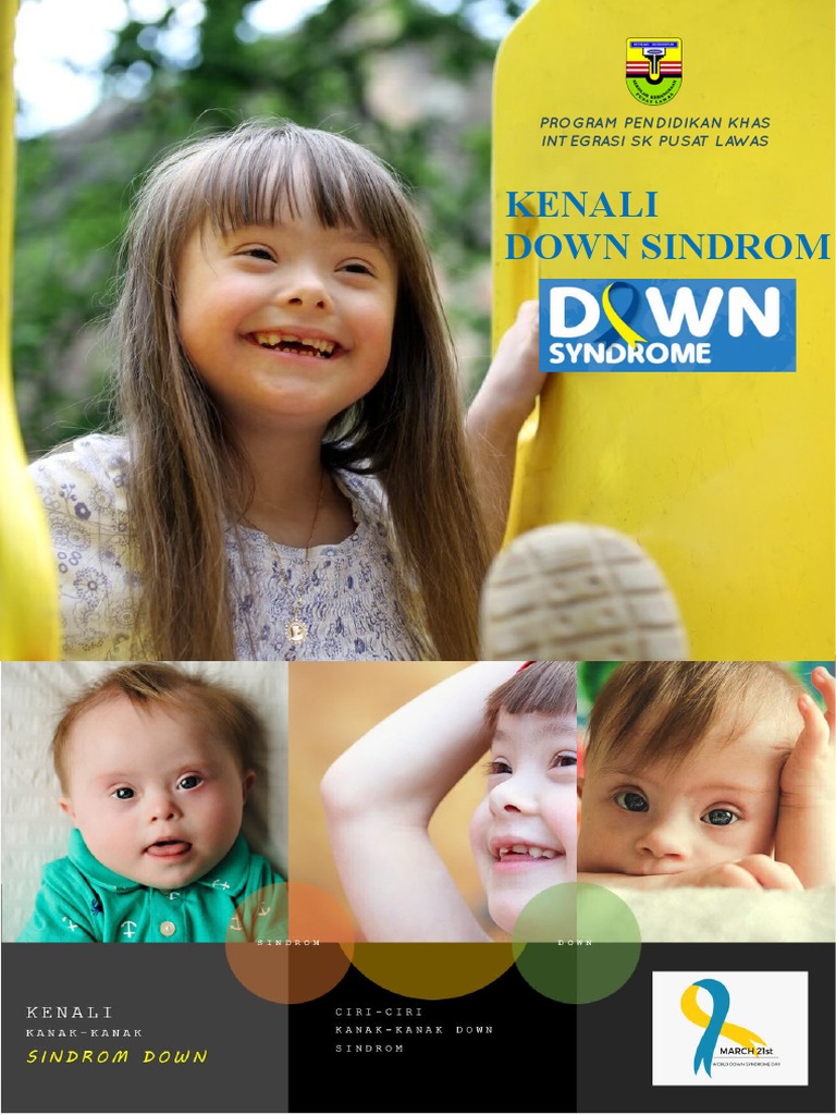 Sindrom Down | PDF
