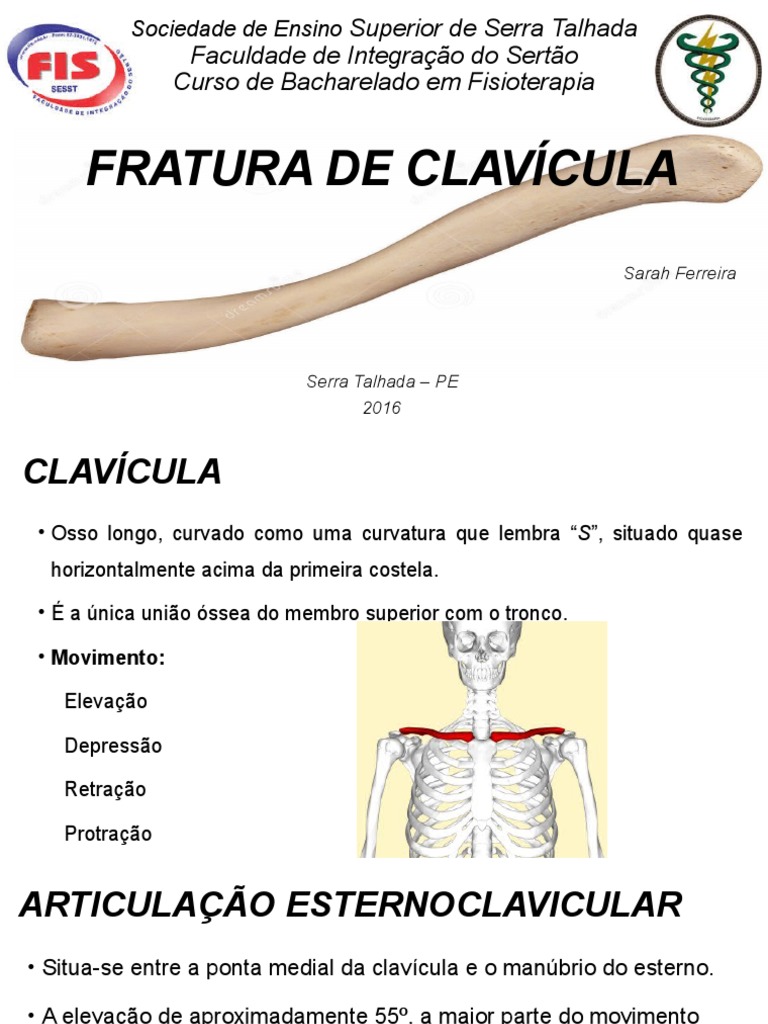 Fratura de Clavícula: Causas e Tratamento | PDF | Sistema Esquelético ...