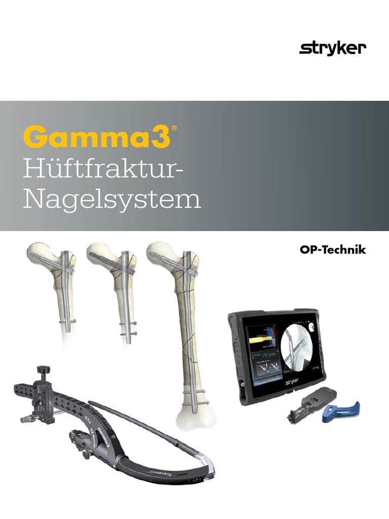 Gamma3 Stryker | PDF | Surgery | Screw
