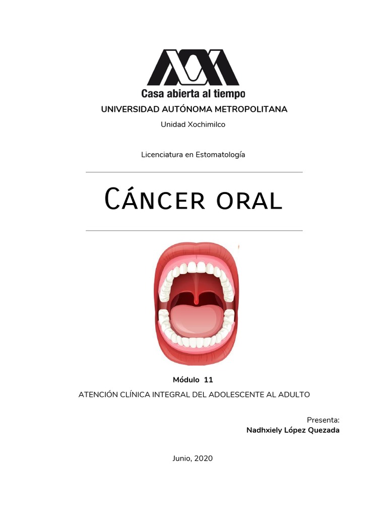 Cáncer Oral | PDF | Cáncer | Metástasis