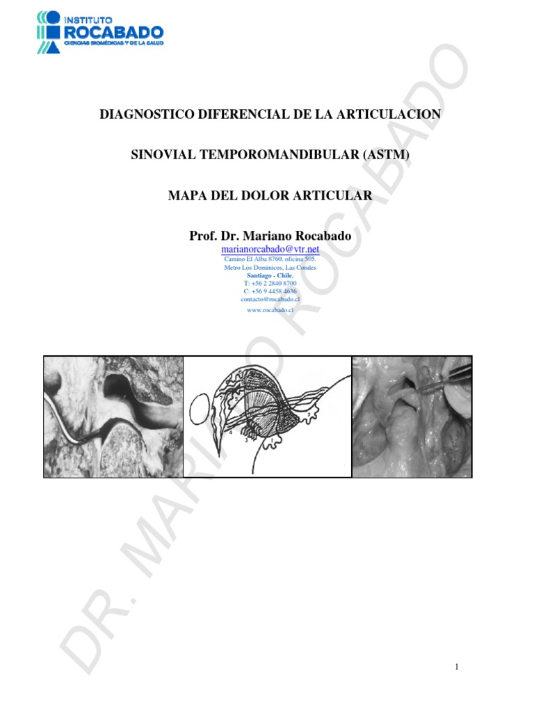 3° MAPA DEL DOLOR (Español) | PDF | Articulación | Mano