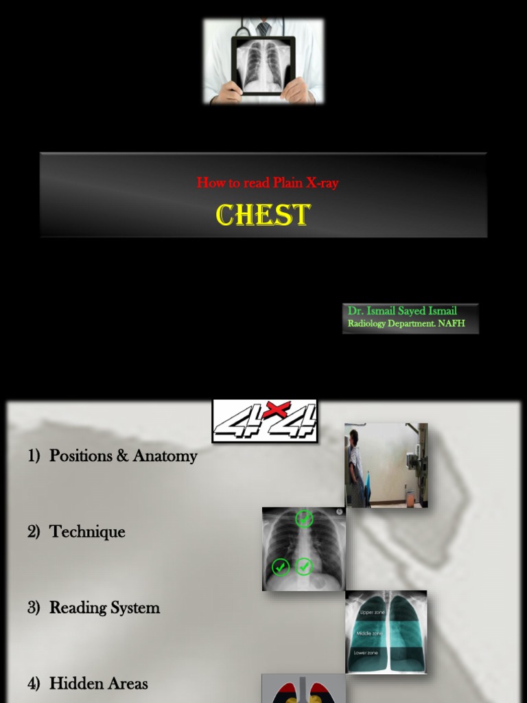 How To Read Chest X-Ray | PDF