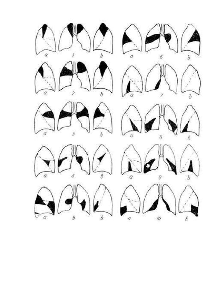 Segmente Pulmoni | PDF