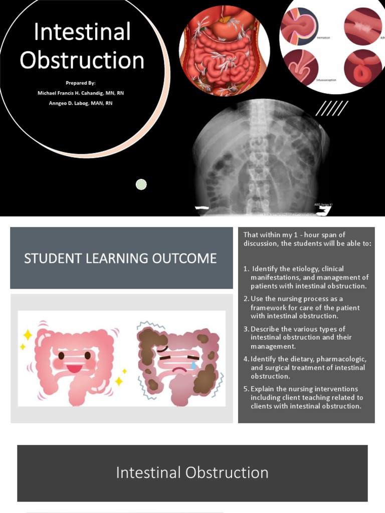 NCM 3260 - Gastro - Intestinal Obstruction | PDF | Hemorrhoid | Human ...