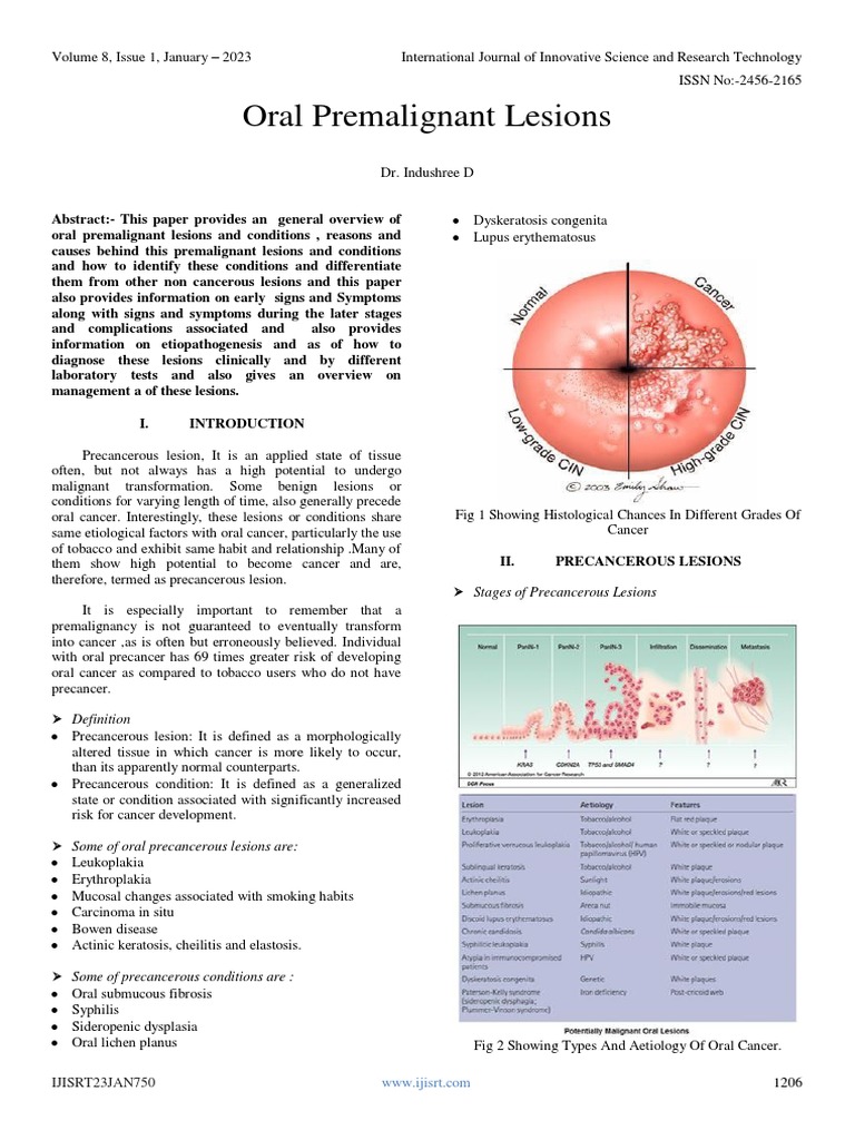 Oral Premalignant Lesions | PDF | Epidemiology | Medicine