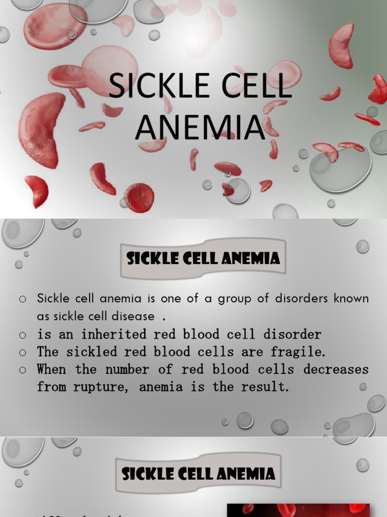 Sickle Cell Anemia | PDF | Anemia | Causes Of Death