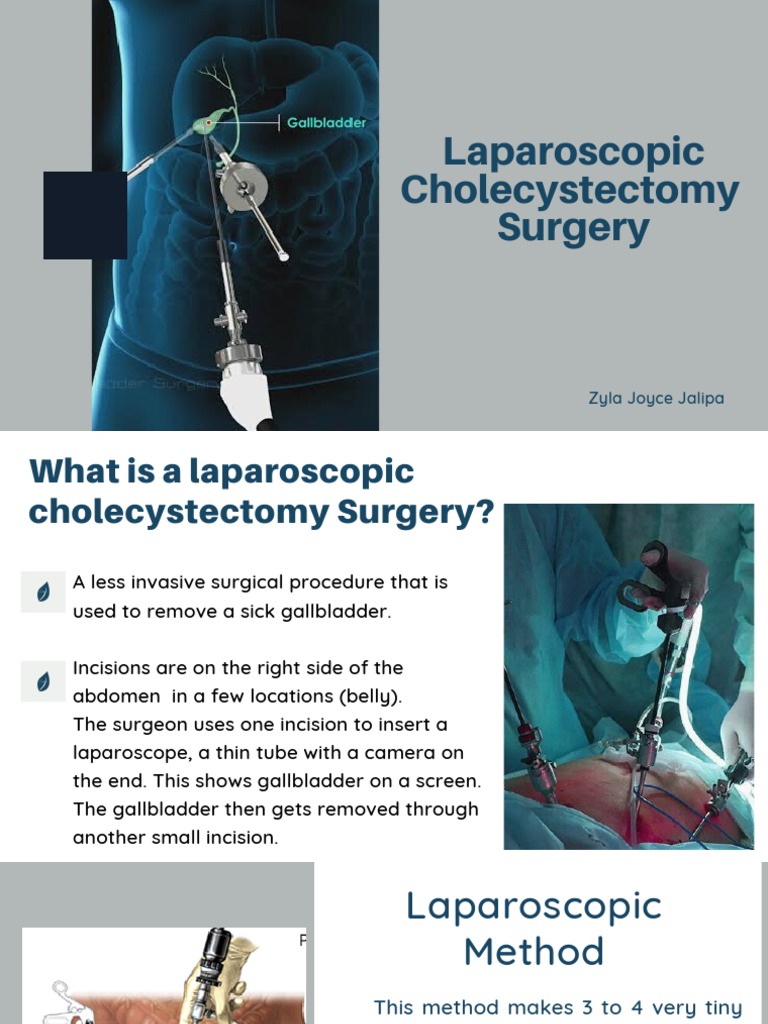 Laparoscopic Cholecystectomy Surgery | Download Free PDF | Gallbladder ...