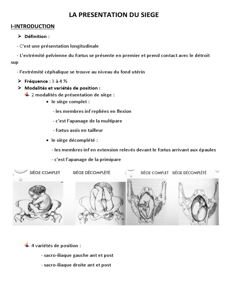 Présentation du Siège : Guide Pratique | PDF | Accouchement ...