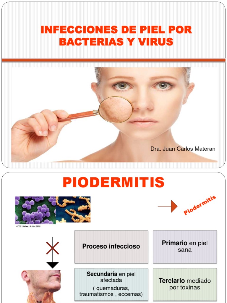 Infecciones Bacterianas y Virales en Piel | PDF | Medicina CLINICA ...