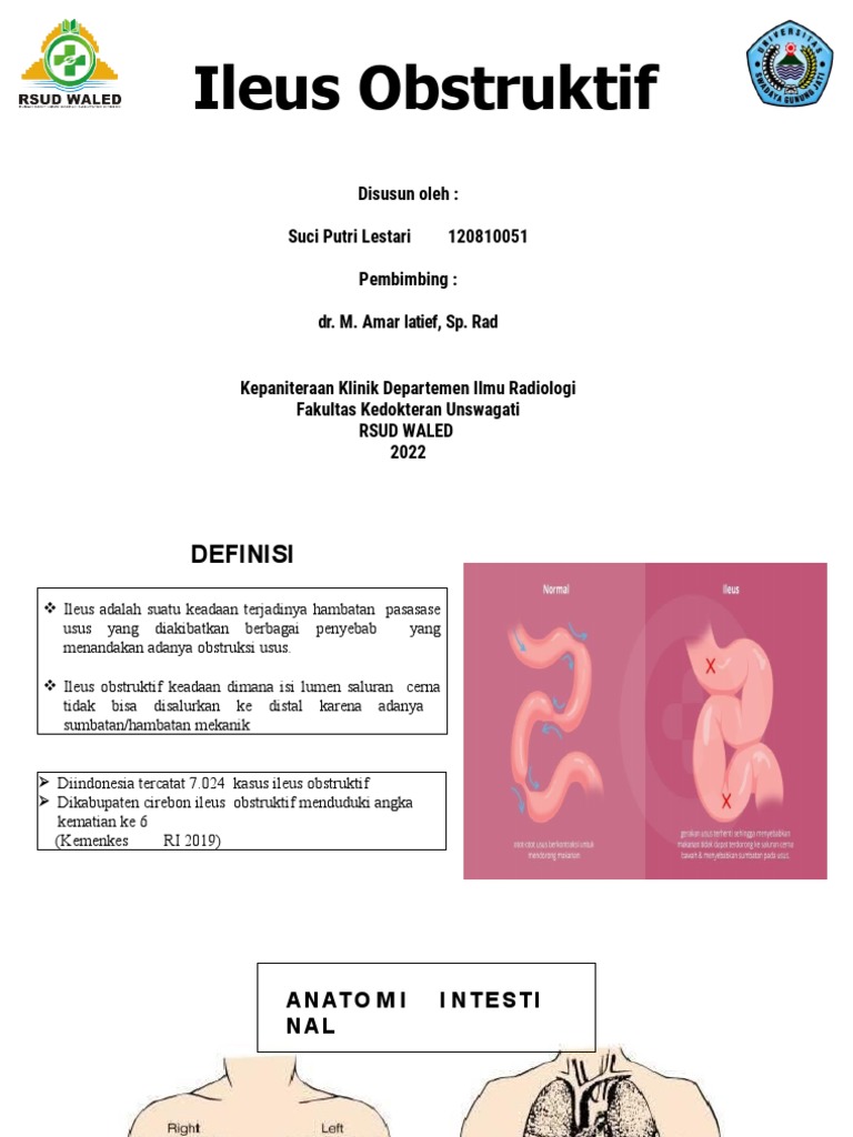 Ileus Obstruktif Radiologi Suci | PDF