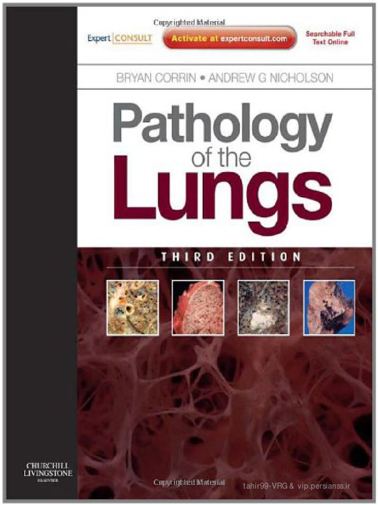 Pathology of The Lungs 3rd Ed (PDF) (Tahir99) VRG | PDF | Lung ...