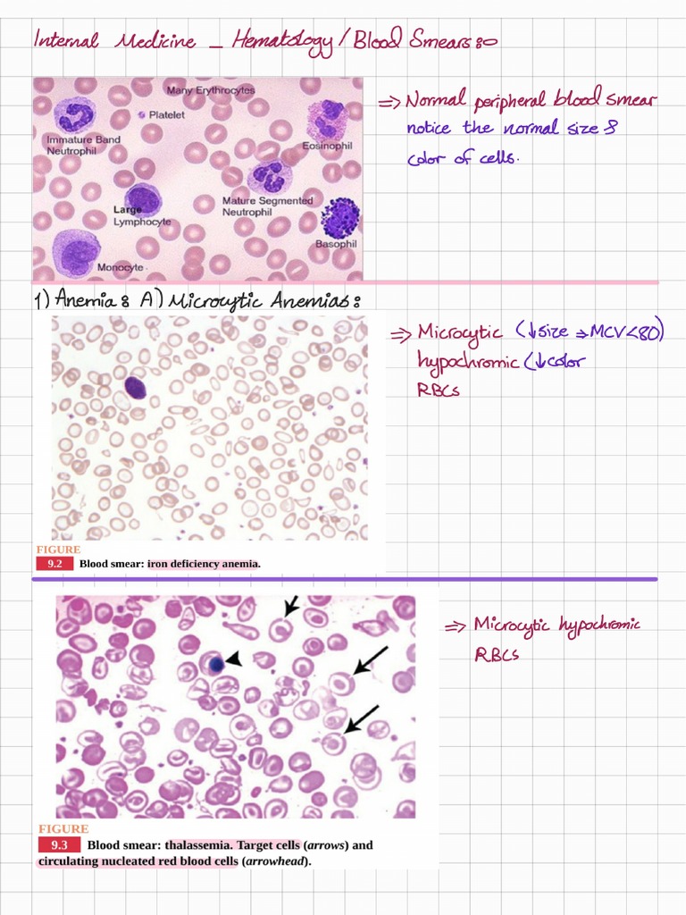 Blood Films | PDF | Cough | Pulse