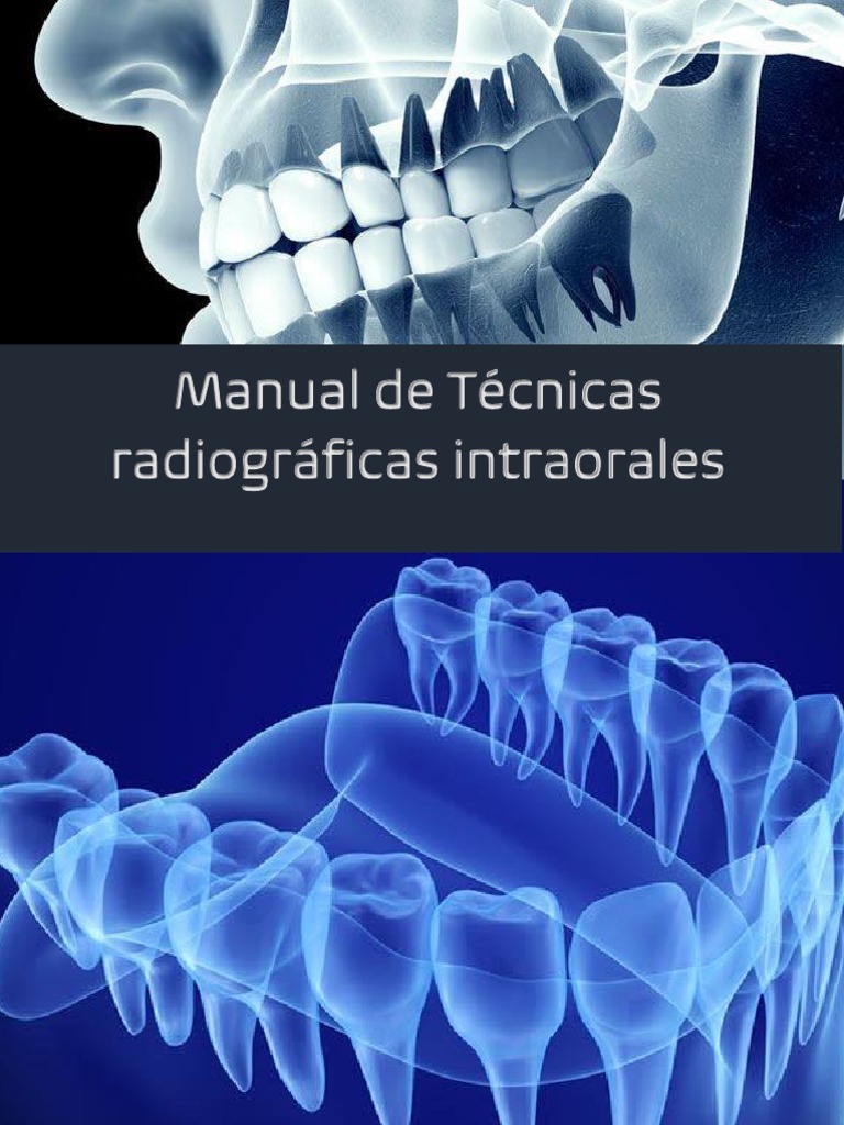 Manual - Técnicas Radiograficas Intraorales | PDF | Odontología | Diente