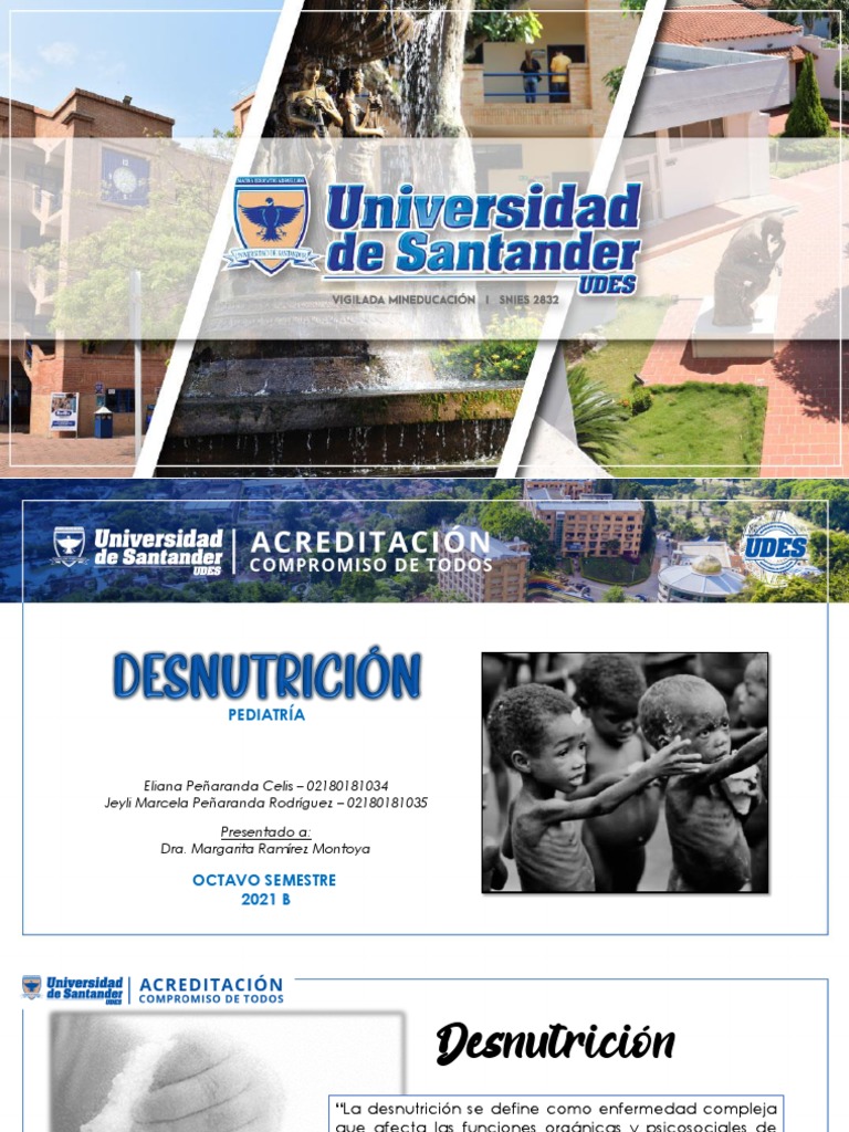 Seminario De Desnutricion Pdf Desnutrición Amamantamiento