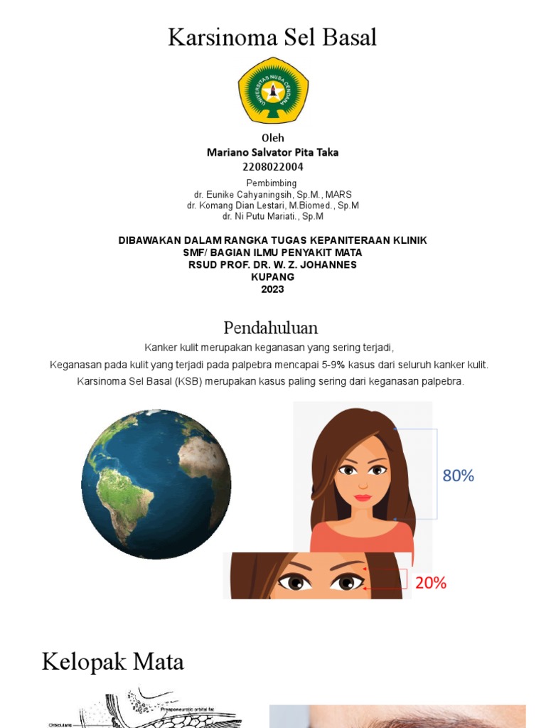 Karsinoma Sel Basal pada Kelopak Mata | PDF