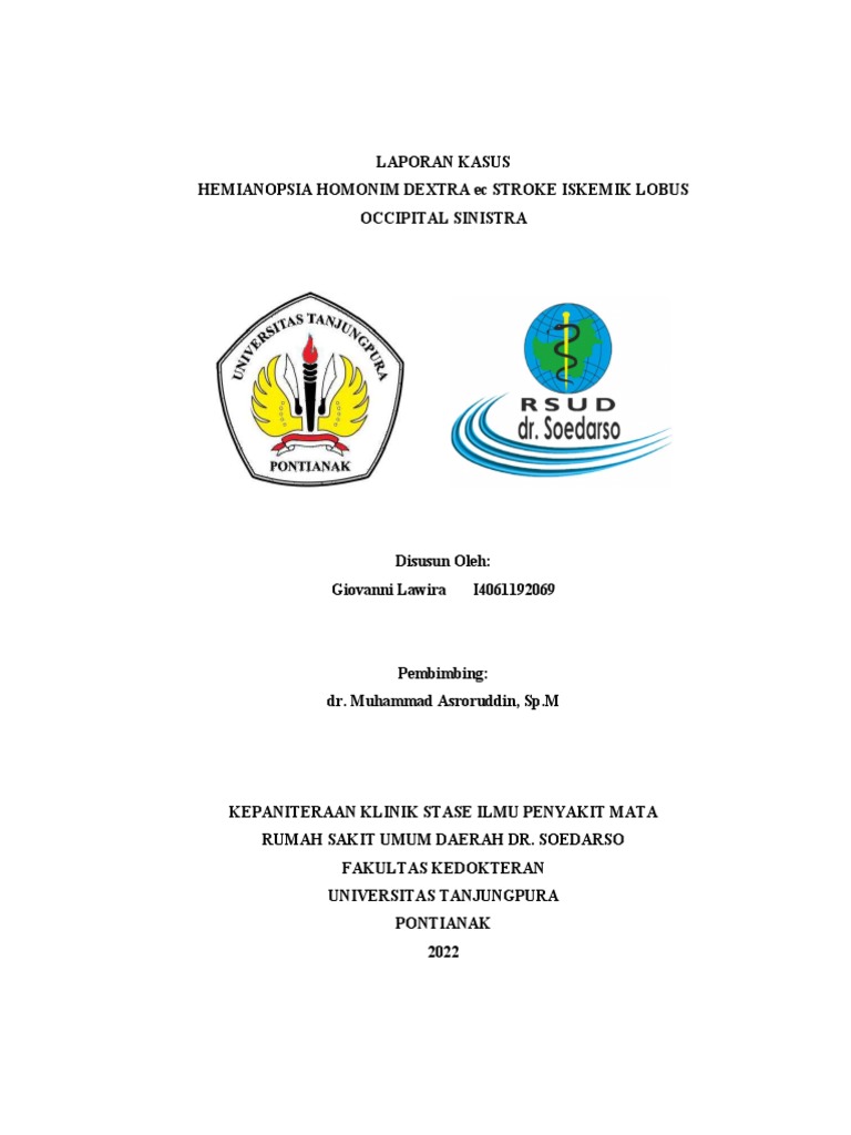 Laporan Kasus - Giovanni Lawira - Hemianopsia Homonim Dextra Ec Stroke Iskemik Lobus | PDF