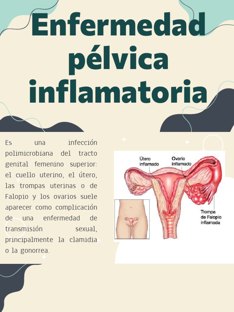 Enfermedad Pelvica Inflamatoria | PDF | Sistema Reproductor Femenino Mamífero | Medicina
