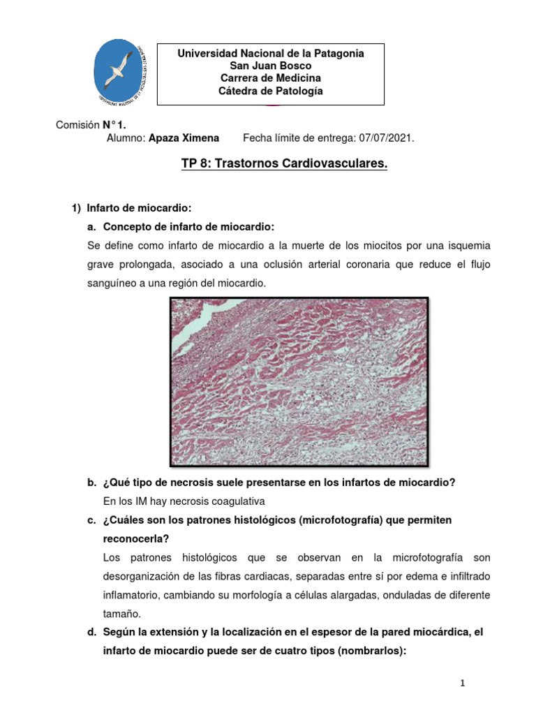 TP8 Trastornos Cardiovasculares | PDF | Infarto de miocardio | Especialidades Medicas