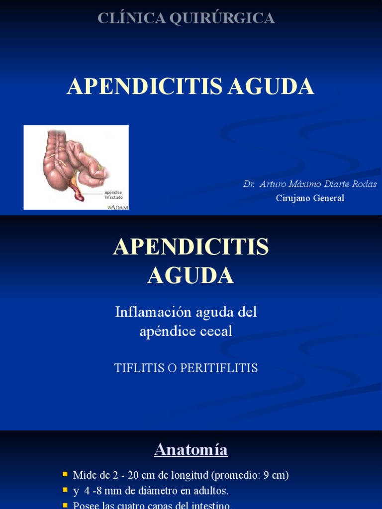 Slide - Apendicitis Aguda | PDF | Causas de la muerte | Ciencias de la Salud