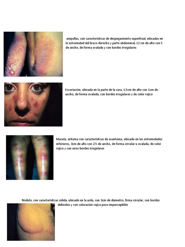 Descripción de Lesiones Cutáneas Variadas | PDF