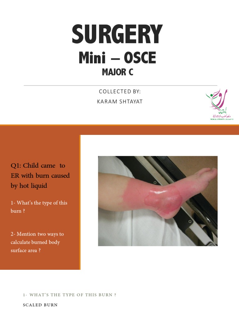 Surgery Mini-OSCE Exam Cases | PDF | Medical Specialties | Clinical ...