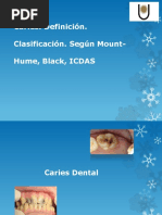 Tabla de Clasificacion ICDAS-ICCMS | PDF | Esmalte de dientes | Diente