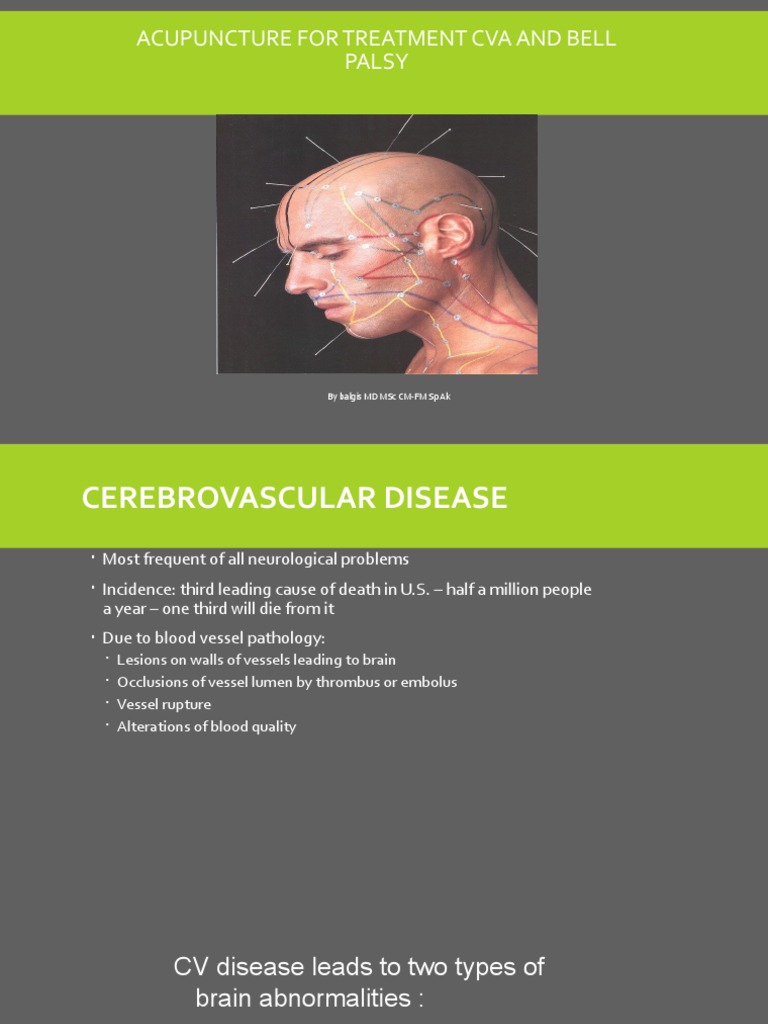 (KULIAH 7) Acupuncture For Treatment Stroke and Bell Palsy | PDF ...