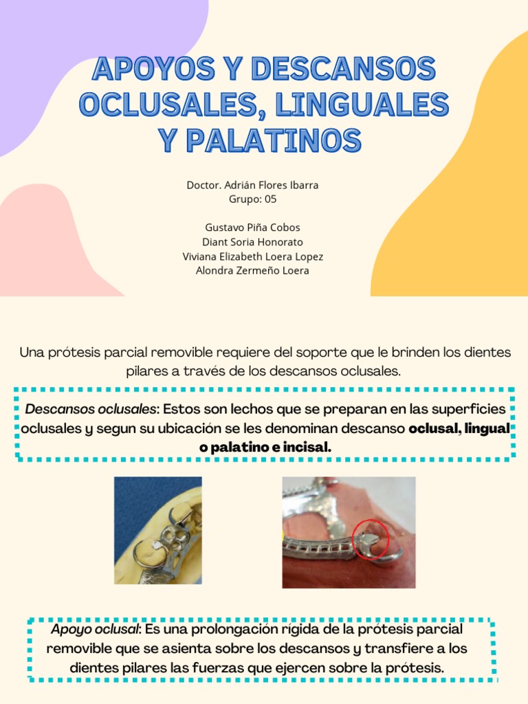 Apoyos Oclusales | PDF | Dentadura postiza | Odontología